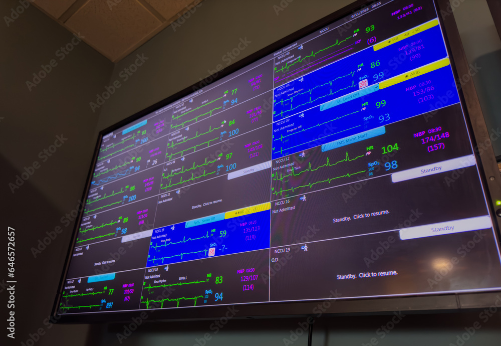 Hospital monitor displays vital signs: heart rate, blood pressure, EKG ...