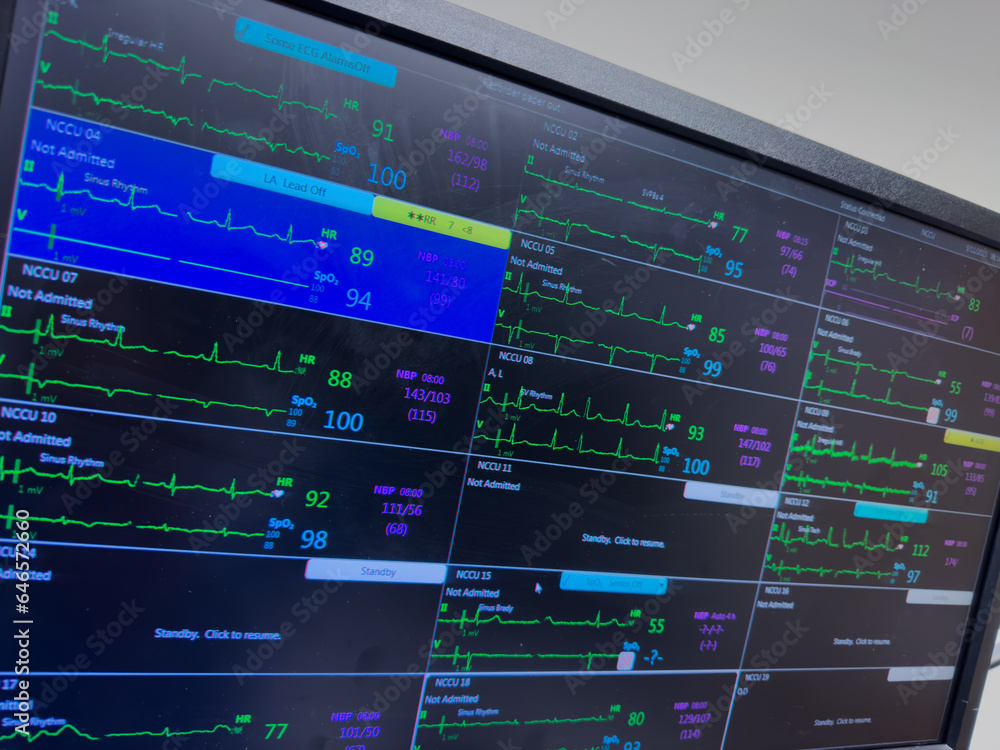 Hospital monitor displays vital signs: heart rate, blood pressure, EKG ...