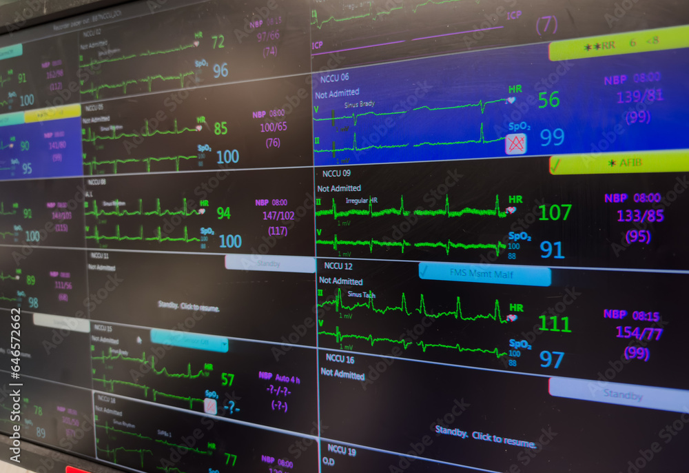 Hospital monitor displays vital signs: heart rate, blood pressure, EKG ...