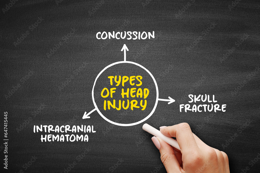 Different types of head injury, mind map text concept for presentations ...