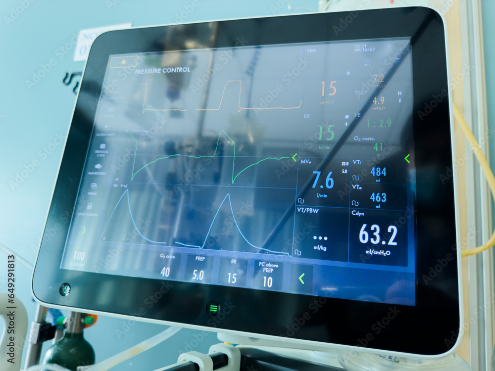 hospital monitor displaying vital signs like heart rate, blood pressure ...