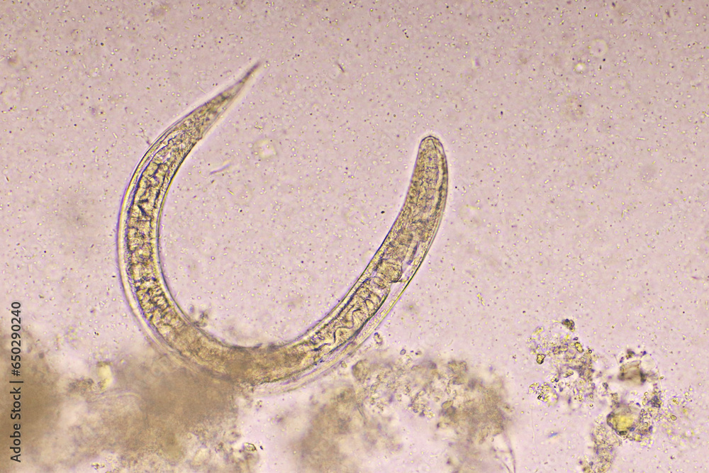 Strongyloides stercoralis or threadworm in human stool, analyze by ...