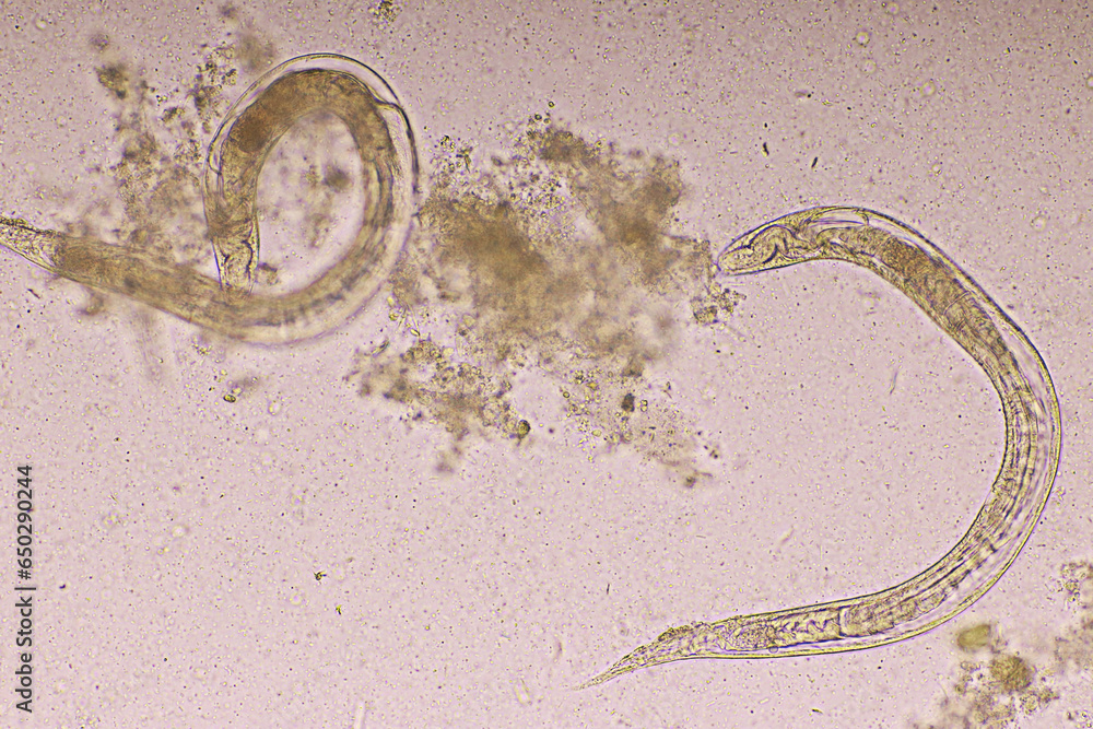 Strongyloides stercoralis or threadworm in human stool, analyze by ...
