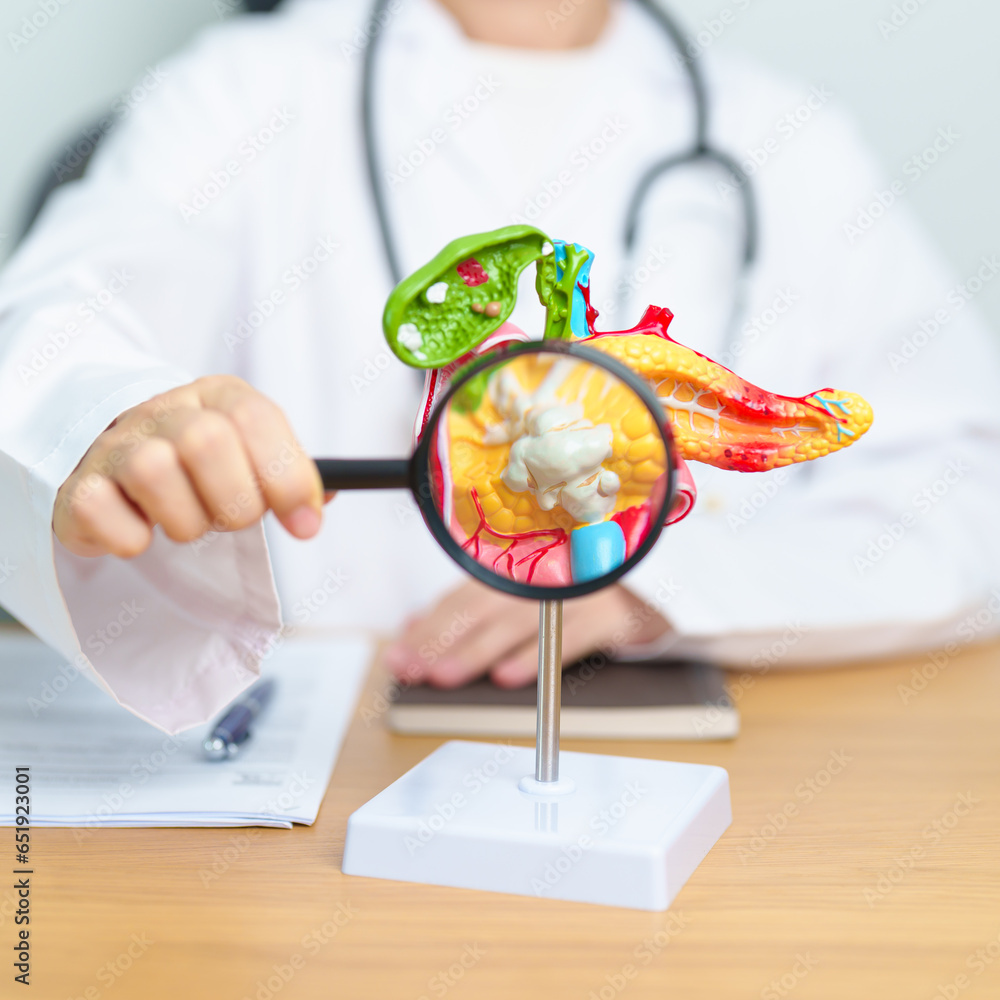 Doctor with human Pancreatitis anatomy model with Pancreas, Gallbladder ...