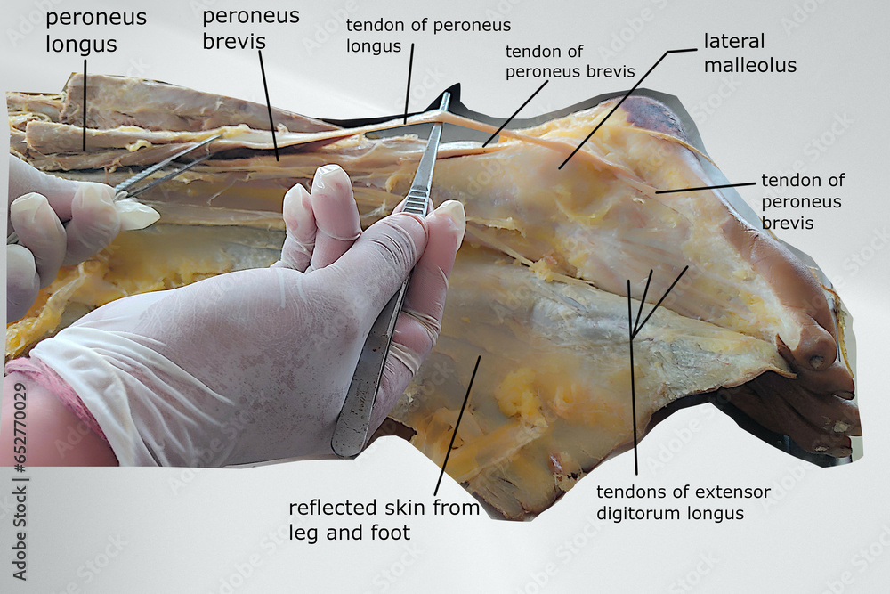 anatomy of lateral compartment of leg. contains related muscles, tendon ...