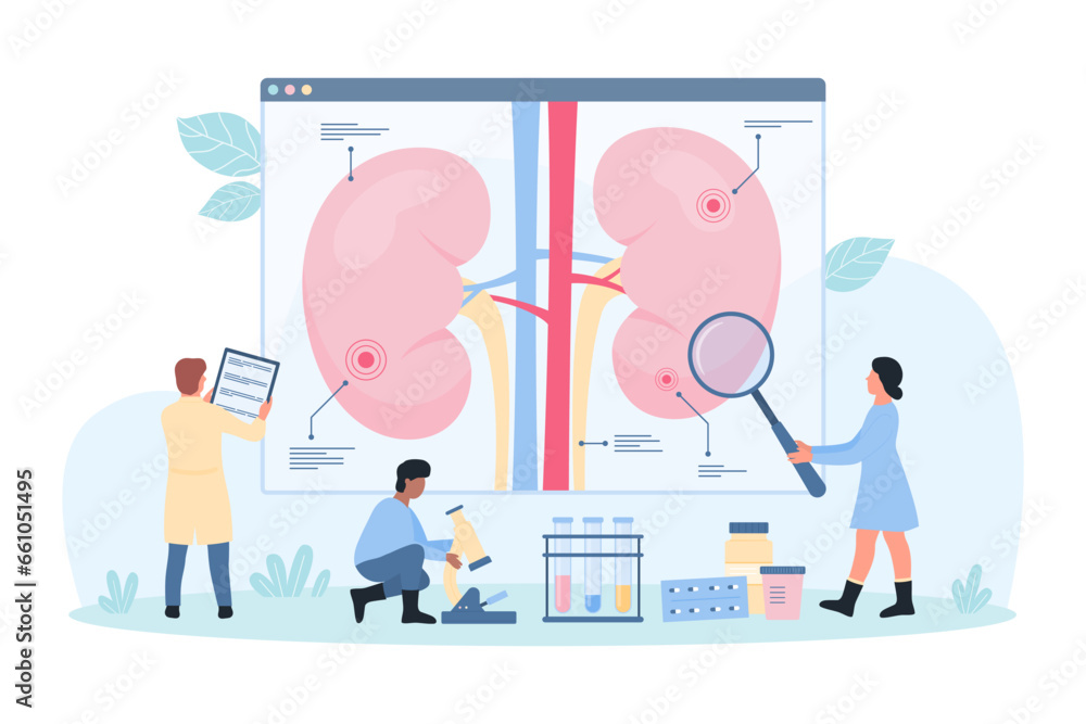 Kidney disease, nephrology vector illustration. Cartoon tiny doctors ...