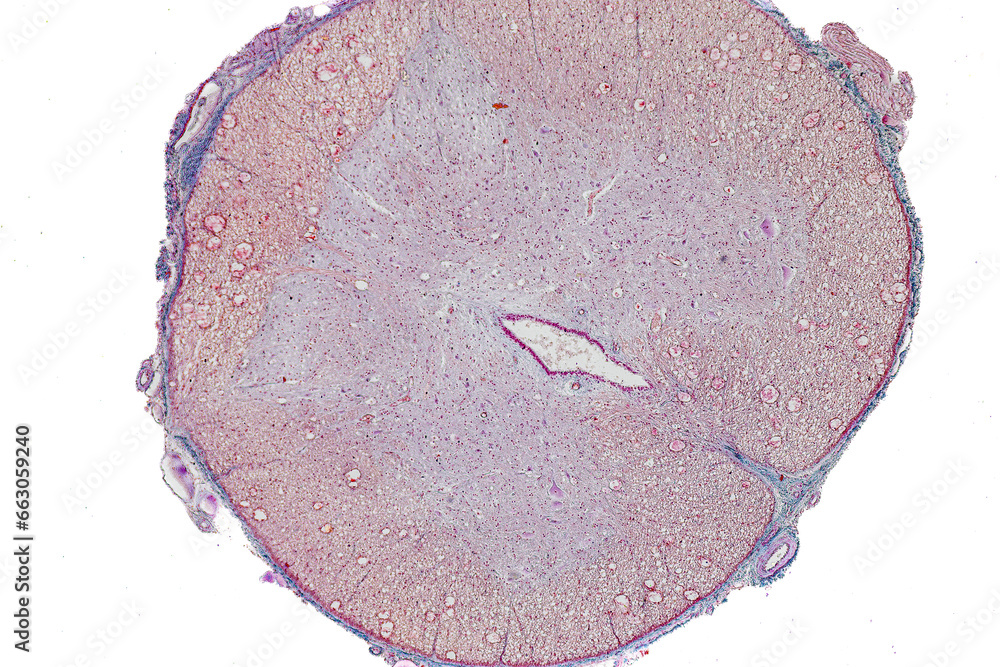 Motor Neuron, Spinal cord, Nerve fibres and nerve cells under the ...
