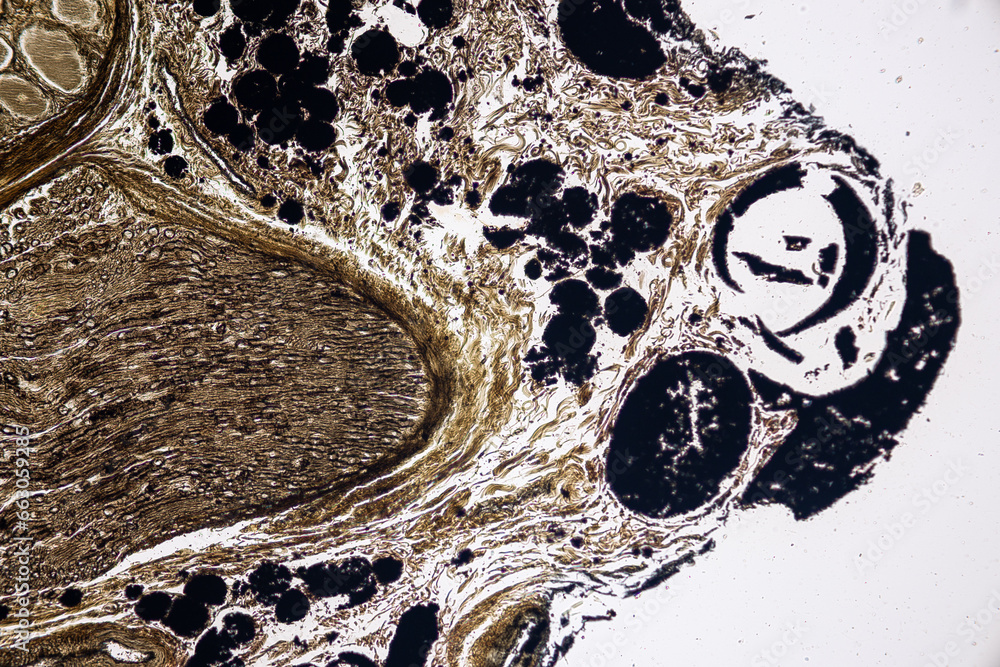 Motor Neuron, Spinal cord, Nerve fibres and nerve cells under the ...