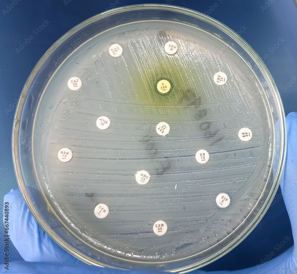 Antimicrobial susceptibility testing in culture plate. Drug sensitivity ...