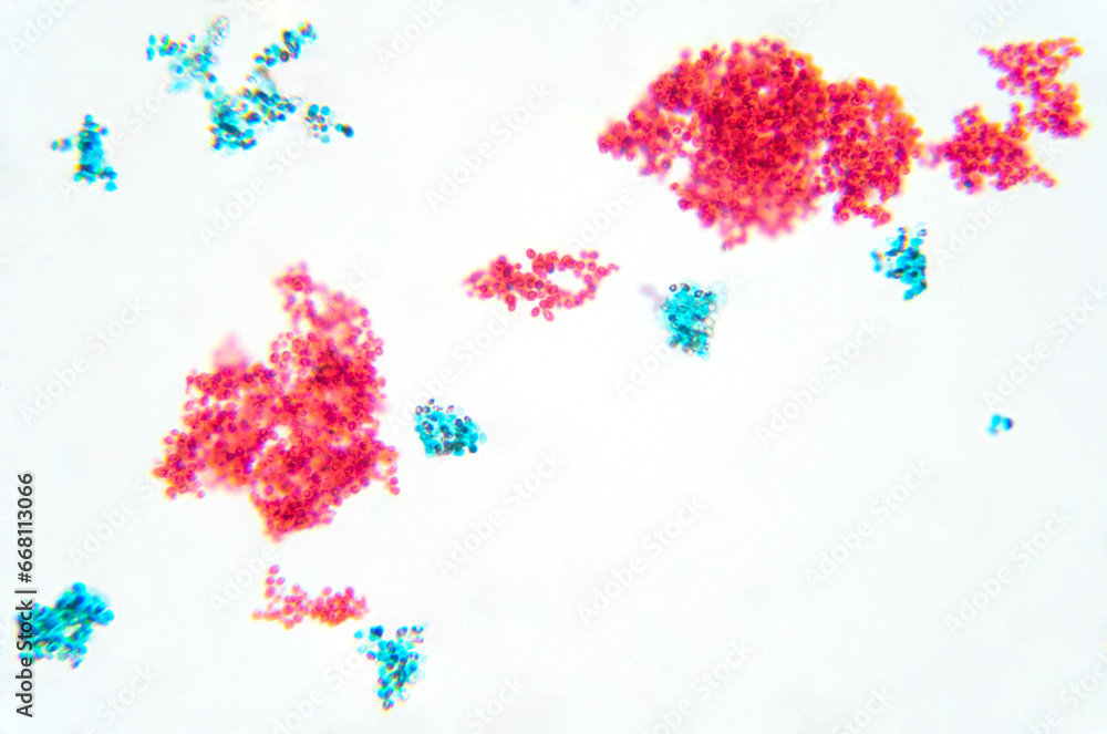 Yeast cells, whole mount, 80X light micrograph. Stained smear of ...