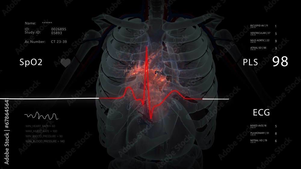 Heart rate monitor MRI x ray CT Scan. Futuristic Technological ...
