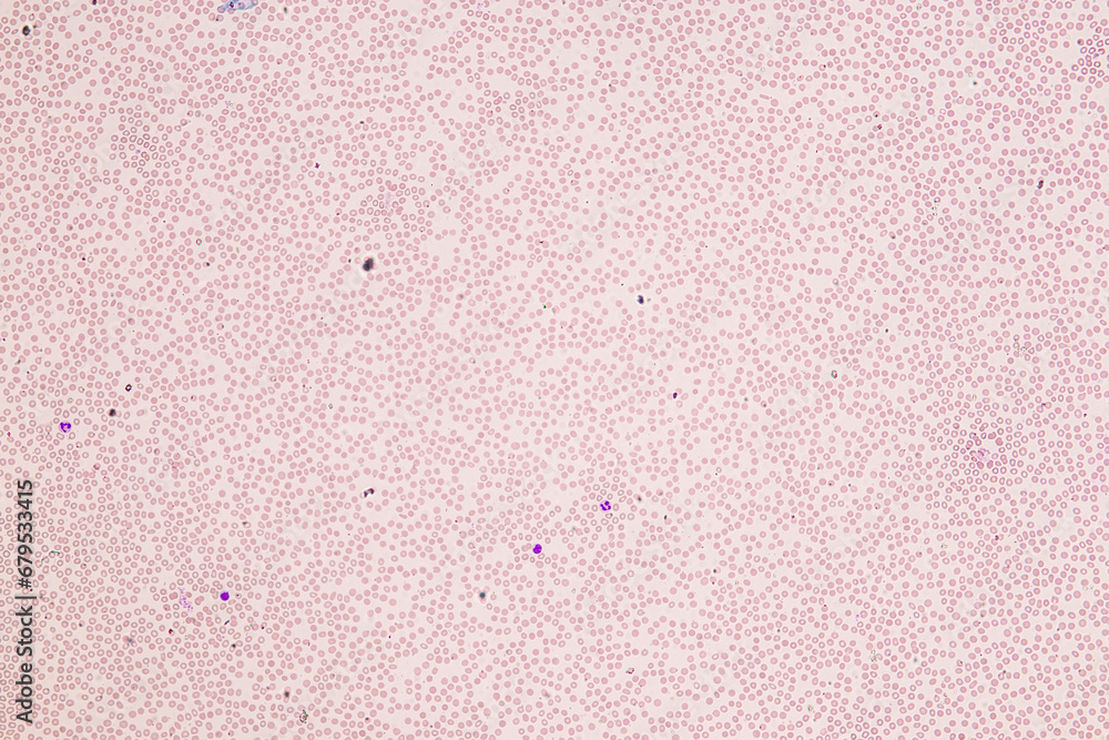 Characteristics Tissue of Thyroid gland, Lymph gland, Larynx of human ...