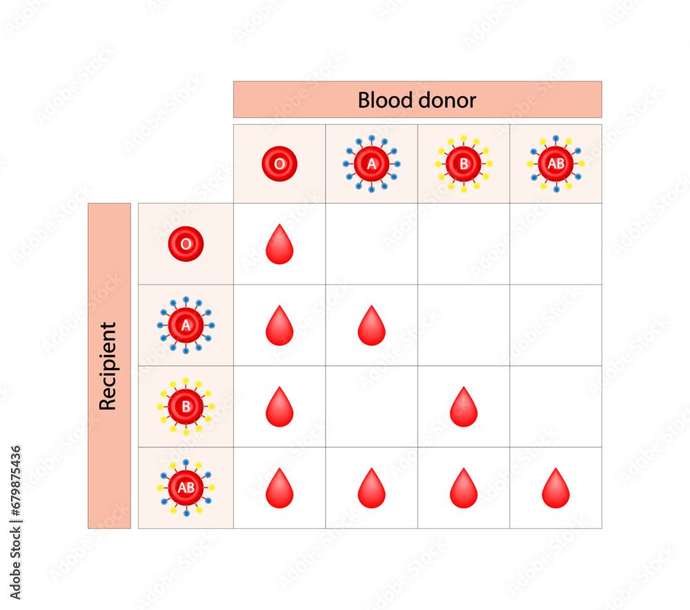 Abo Blood Compatibility Chart. Blood donation, ABO Blood groups ...