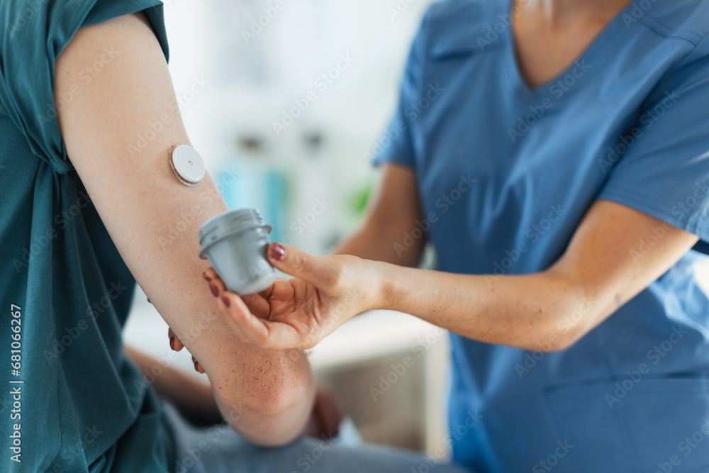 Nurse applying a continuous glucose monitor sensor on arm of a diabetic ...