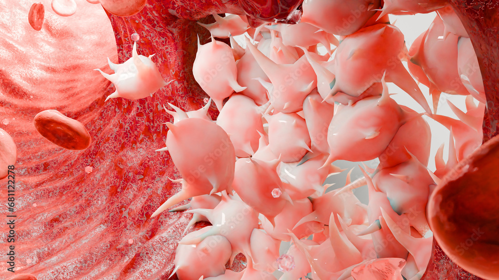 Hemostasis. Red blood cells and platelets in the blood vessel ...