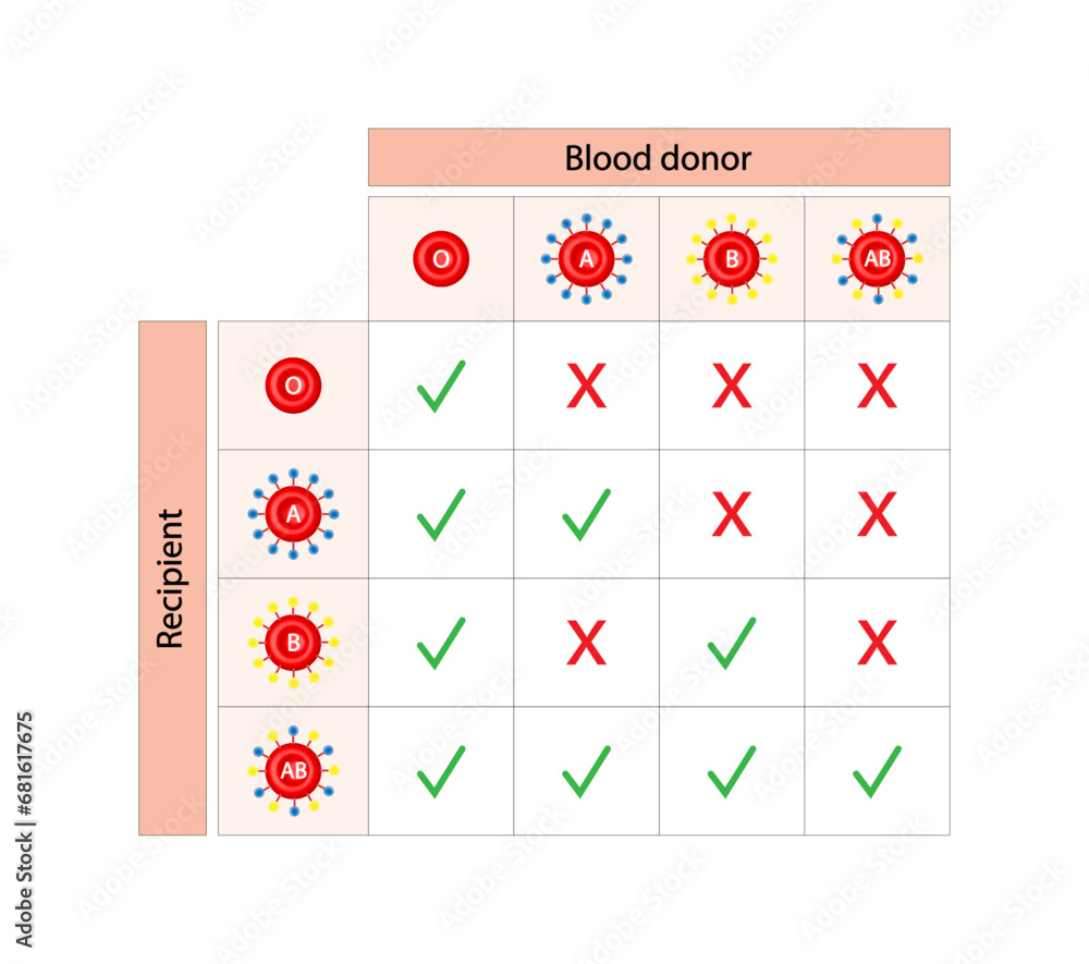 Abo Blood Compatibility Chart. Blood donation, ABO Blood groups ...
