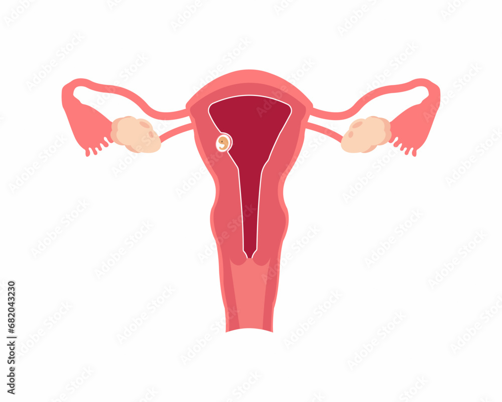 Embryo implantation embryo wall of the uterus embryo development from ...