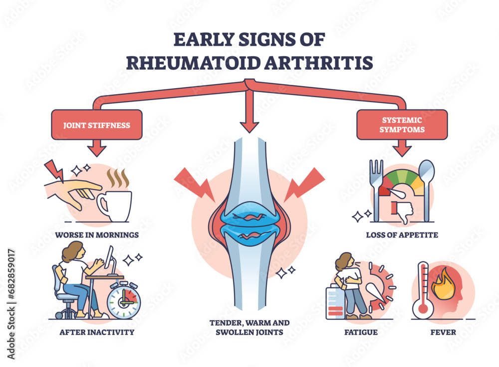 Early signs of rheumatoid arthritis disease and joint pain outline ...