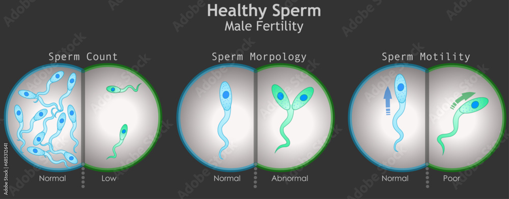 Sperm healthy, male fertility. Microscopic cells compare. Count, morphology, motility. Compare ...