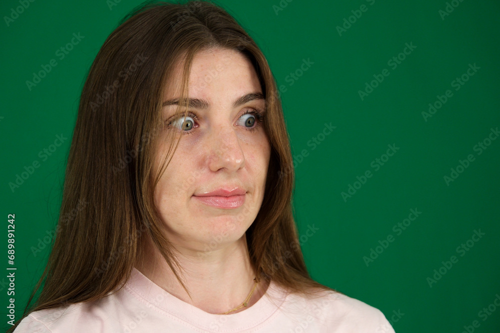 Macro closeup of young woman face with Grave's disease hyperthyroidism ...