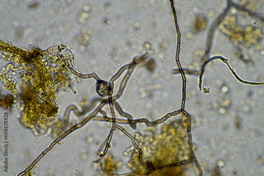 soil microbes under the microscope. microorganisms with fungus Stock ...