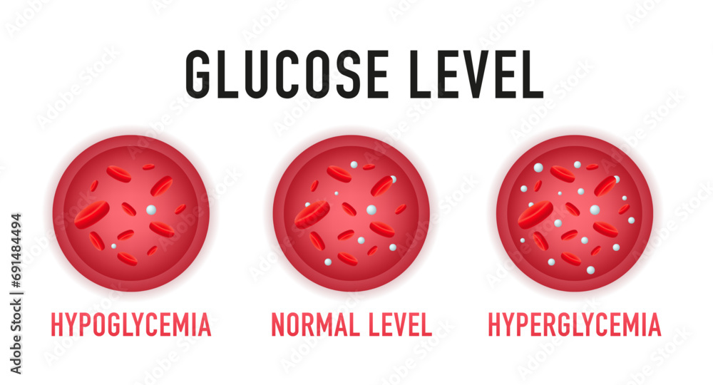 Hyperglycemia, High Blood Sugar and Diabetes ,obesity is a serious ...