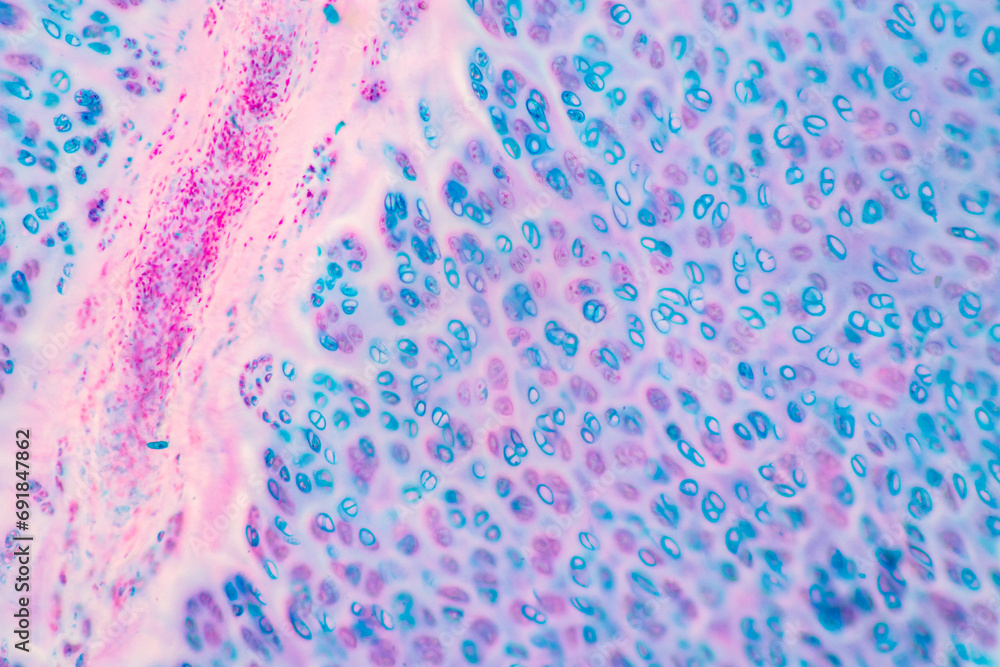 Anatomy and Histological Rea Bone marrow Human, Hyaline cartilage human ...