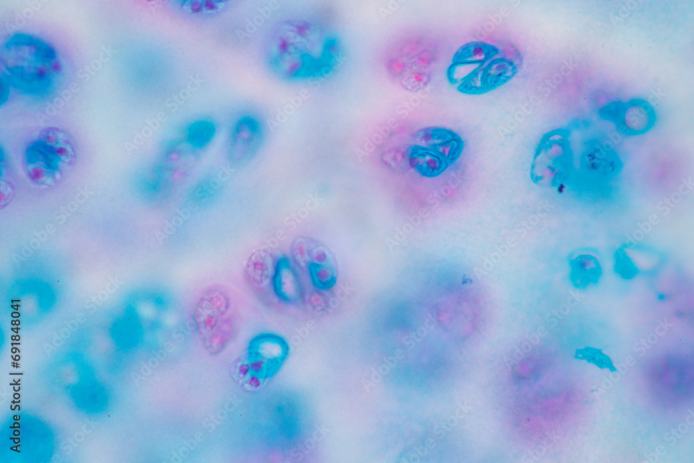 Anatomy and Histological Rea Bone marrow Human, Hyaline cartilage human ...