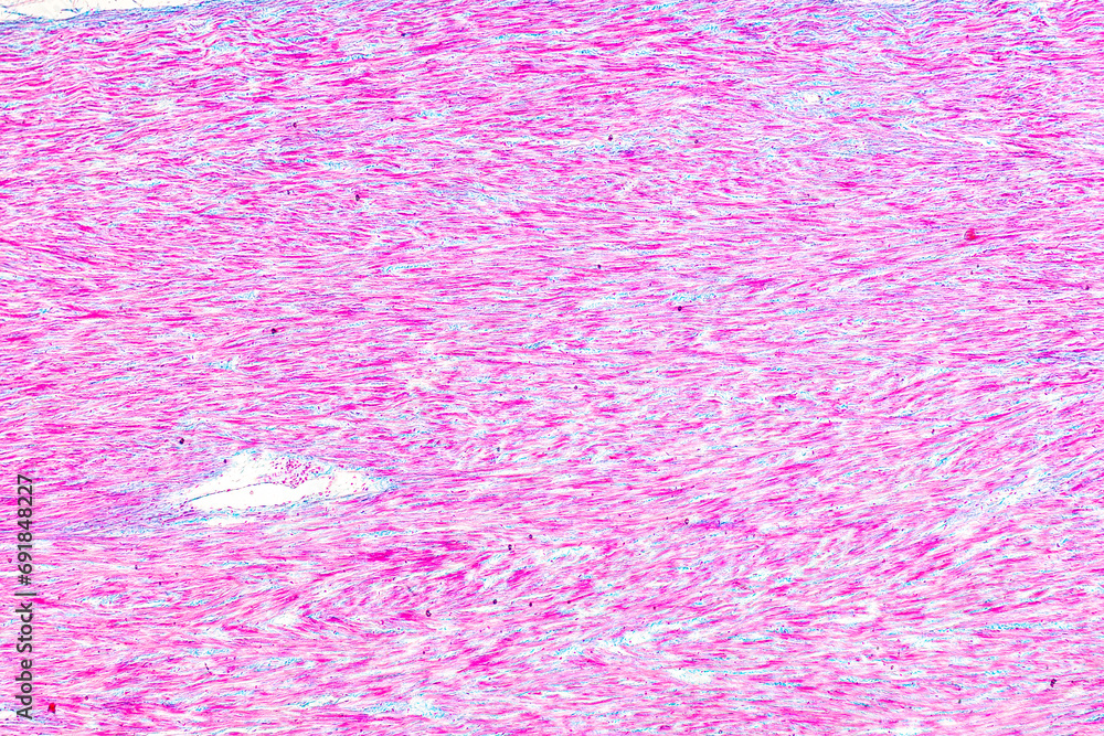 Anatomy and Histological Rea Bone marrow Human, Hyaline cartilage human ...