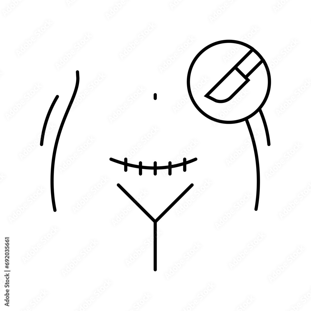 cesarean section gynecologist line icon vector. cesarean section ...