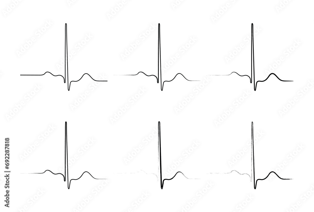 Ventricular repolarization, Cardiac cycle, ECG of heart in normal sinus ...