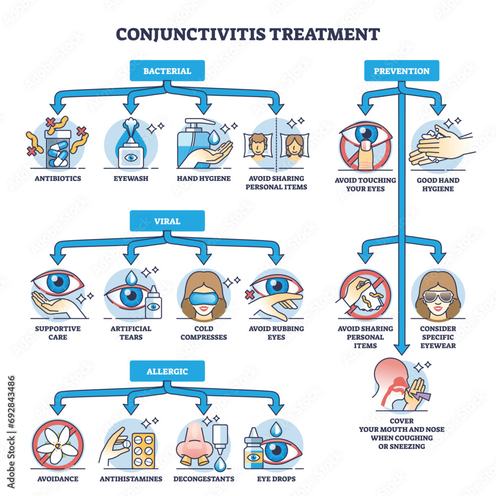 Image vectorielle Stock Conjunctivitis treatment for bacterial, viral ...