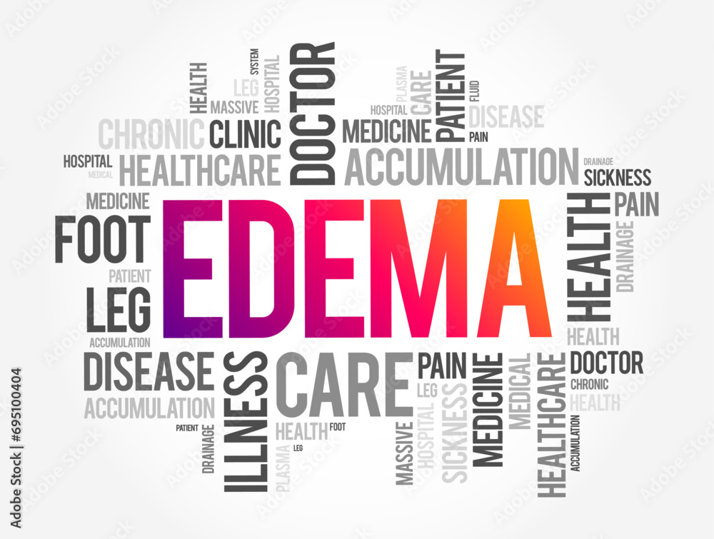 Edema is swelling caused by excess fluid trapped in your body's tissues ...