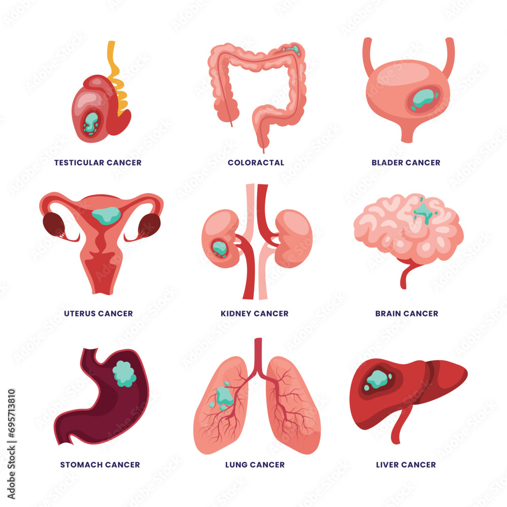Set of different types of Common cancer types set collection ...