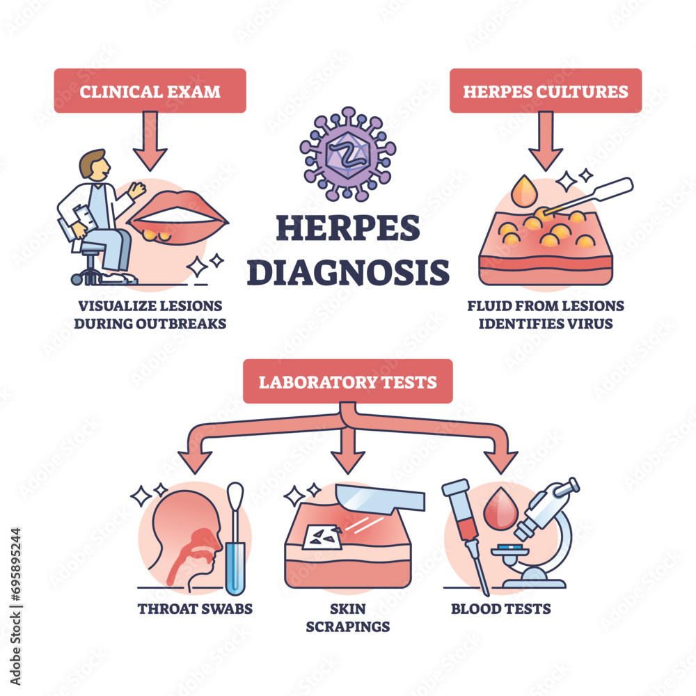 Herpes diagnosis and HSV virus medical diagnosis methods outline diagram. Labeled educational ...