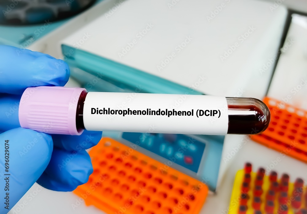 Blood sample tube for DCIP (dichlorophenol indophenol precipitation ...
