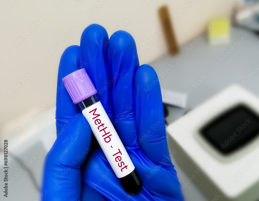 Methemoglobin is a form of hemoglobin, With methemoglobinemia, the ...