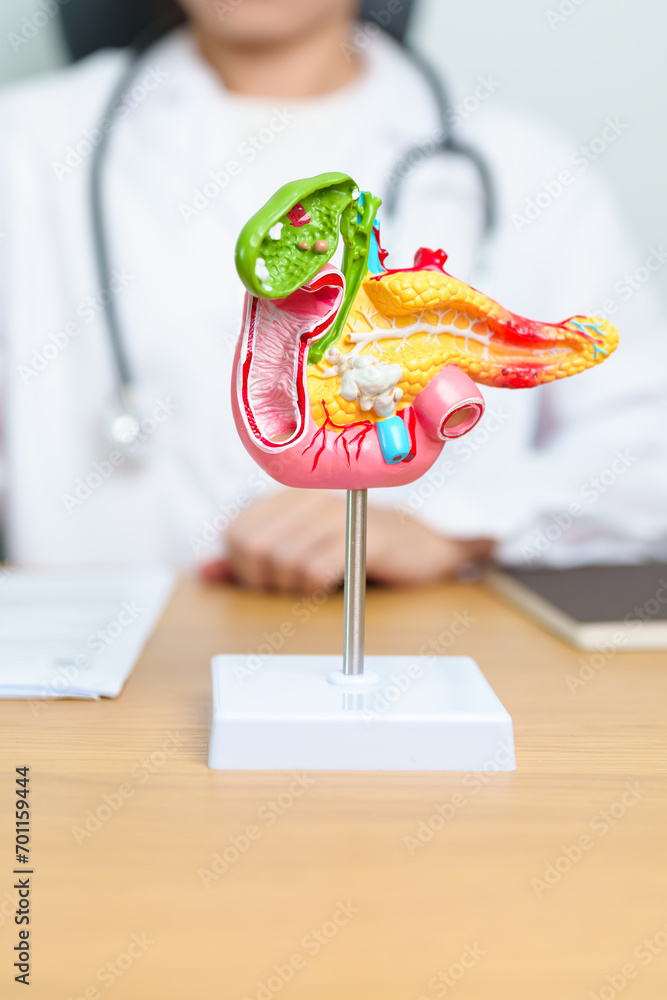 Doctor with human Pancreatitis anatomy model with Pancreas, Gallbladder ...