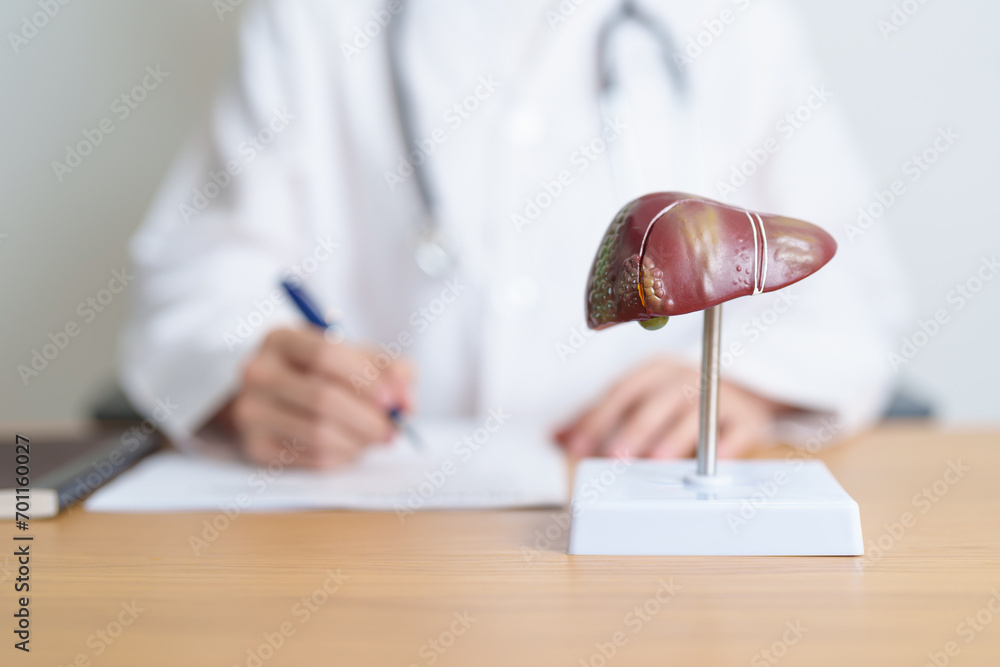 Doctor with human Liver anatomy model. Liver cancer and Tumor, Jaundice ...