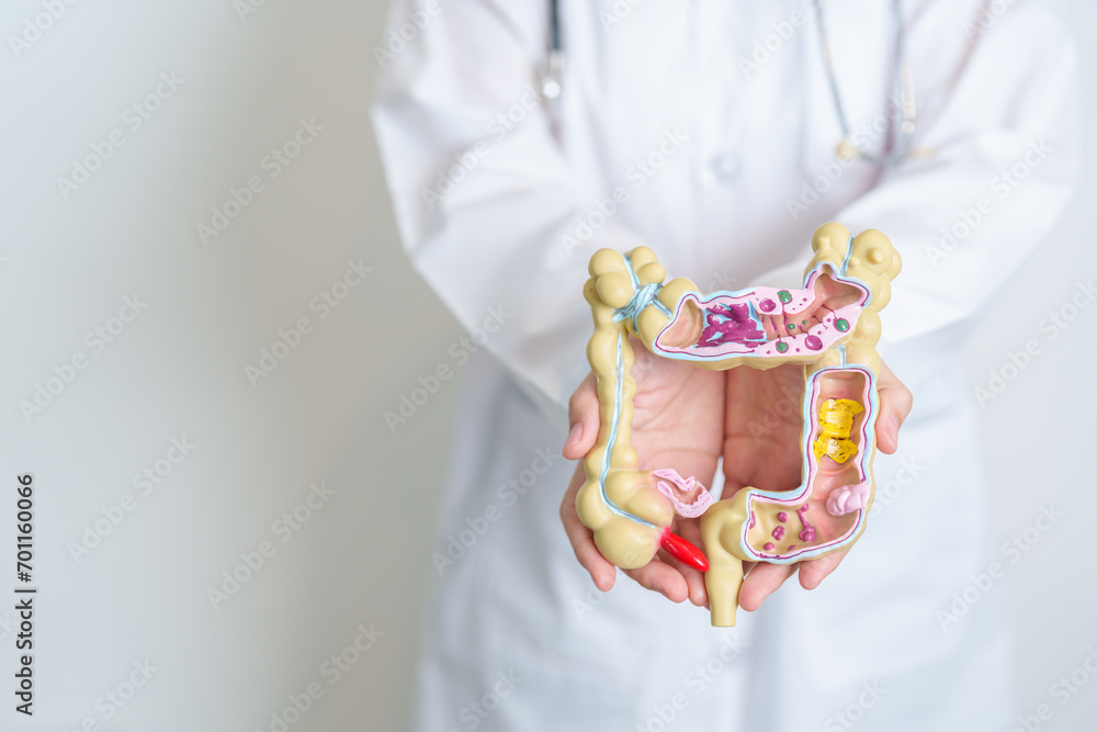 Doctor holding human Colon anatomy model. Colonic disease, Large ...