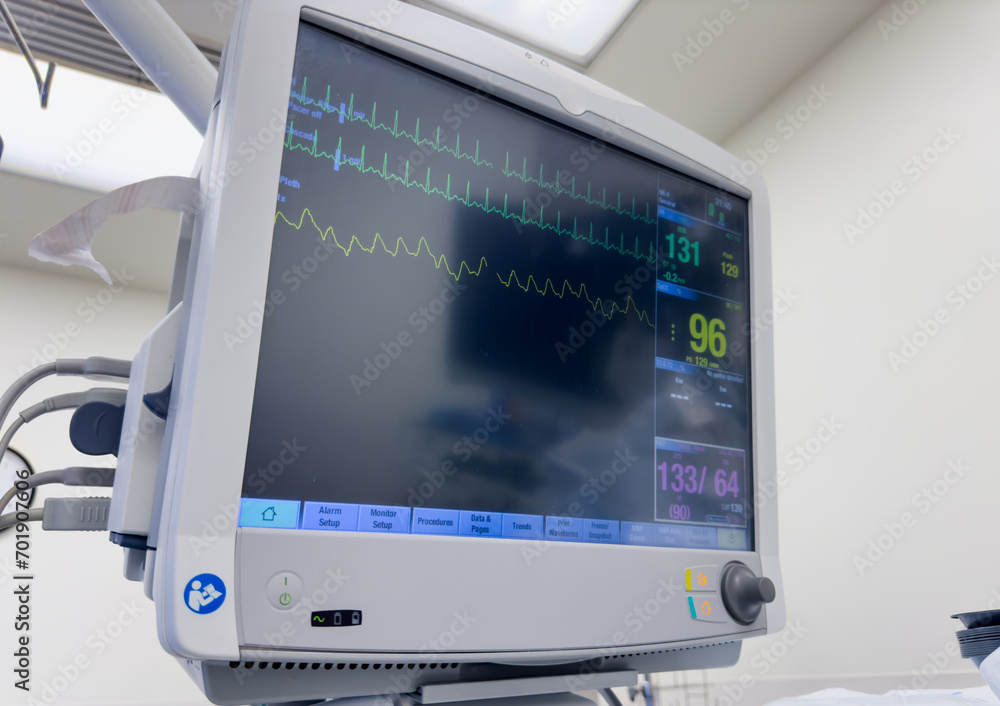 Hospital monitor displays vital signs, healthcare concept, medical ...