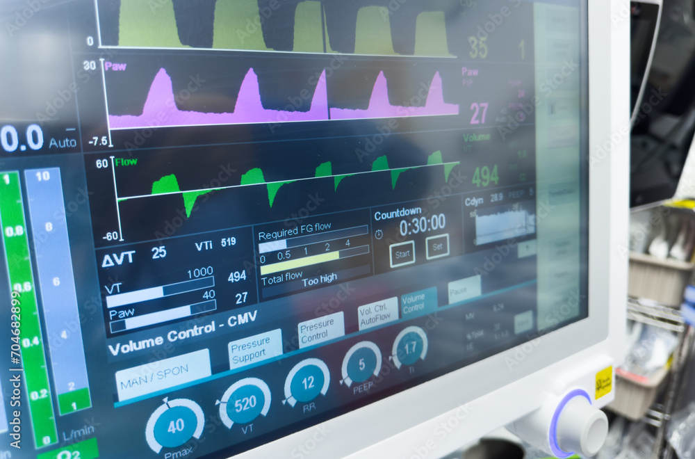 Hospital monitor displaying vital signs: heart rate, blood pressure ...