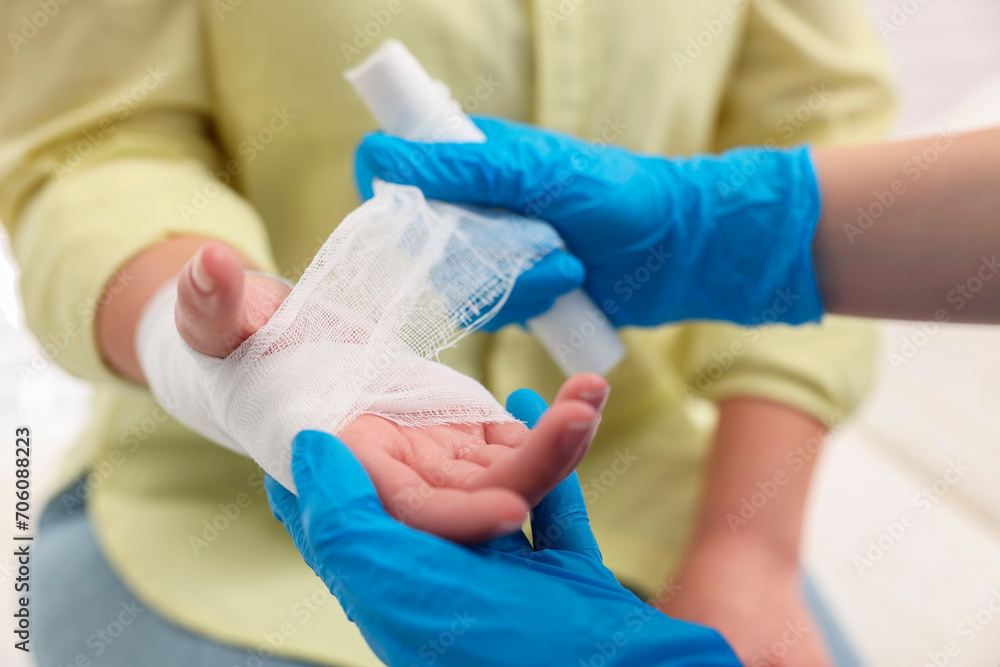 Doctor bandaging patient's burned hand indoors, closeup Stock Photo ...