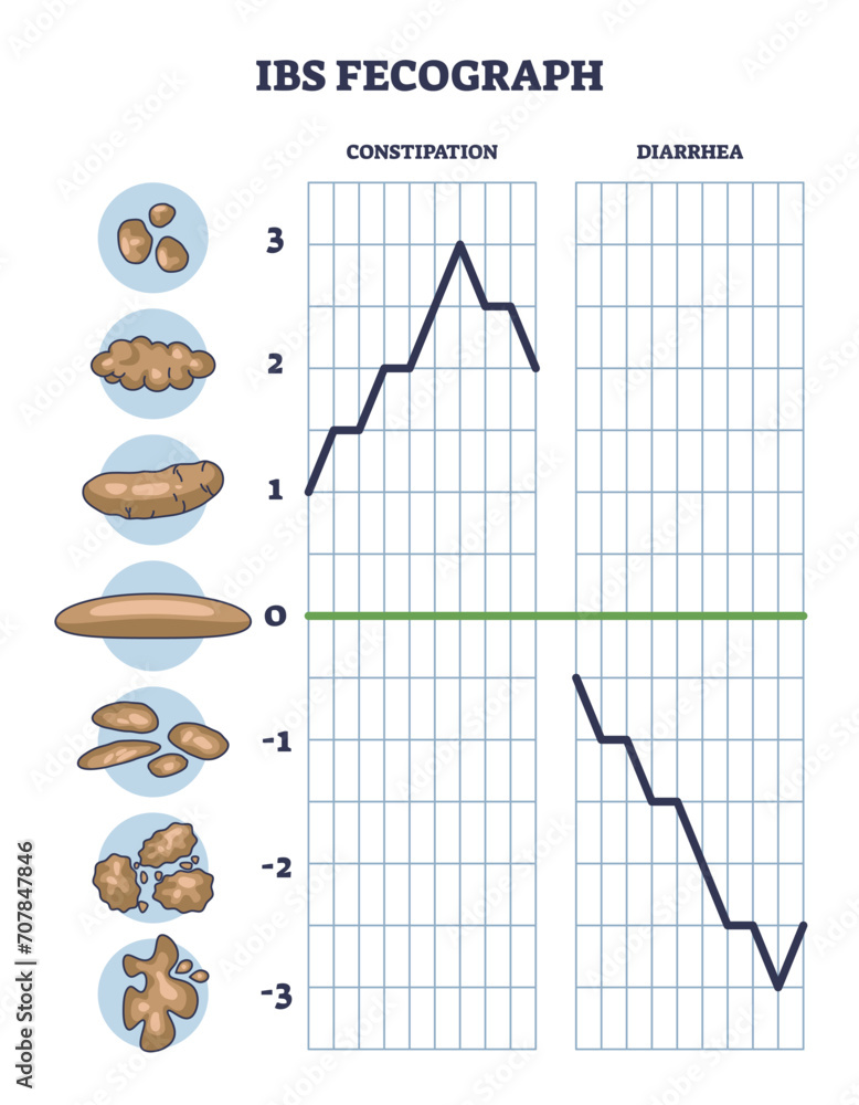 IBS fecograph as daily bristol stool form representation outline ...