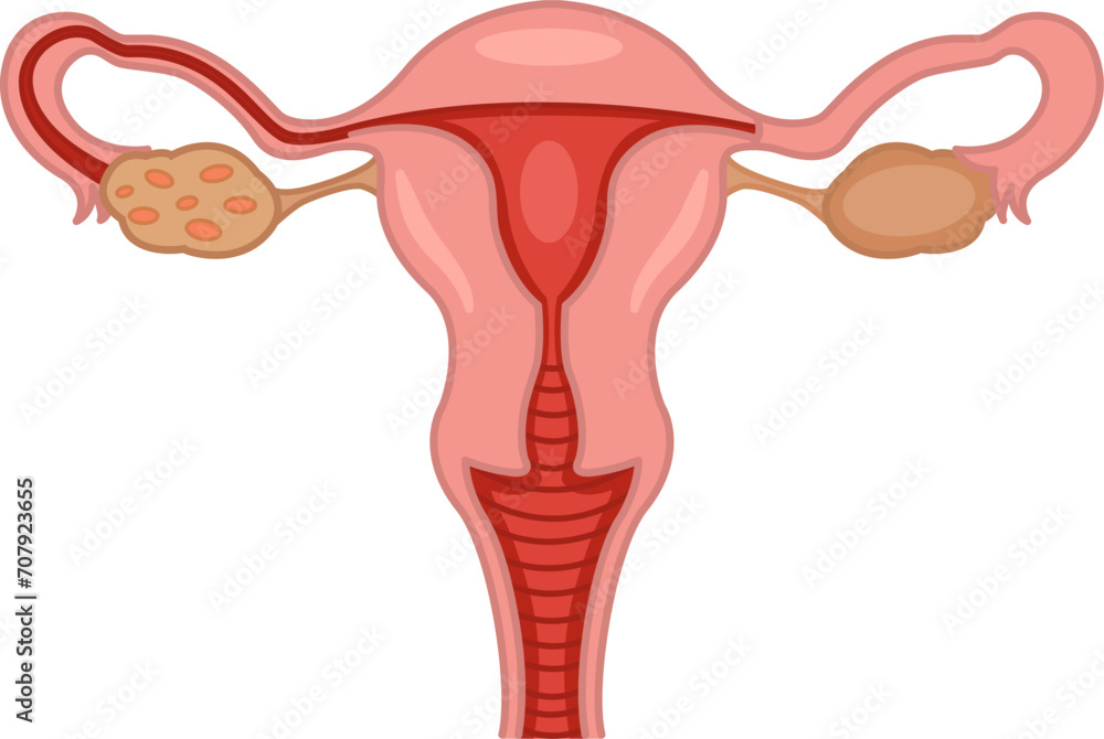 Female Reproductive System. Vector Illustration of Healthy Female Reproductive Organs. Human ...