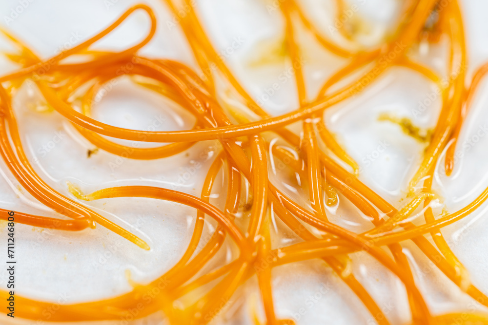 Study of Parasitic helminths (Trematodes) and Ascaris of fishes under a ...