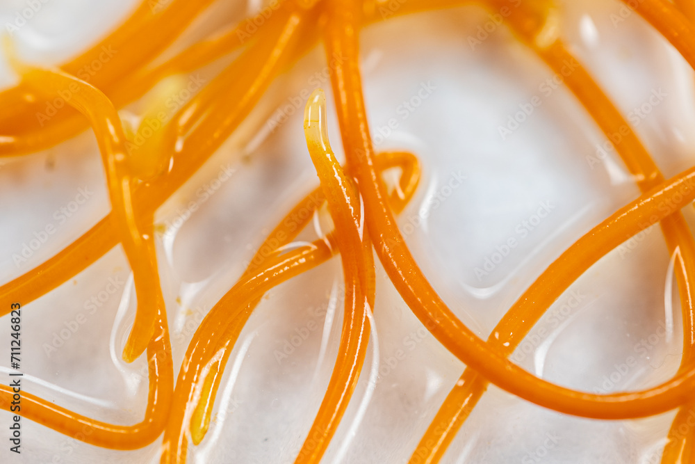 Foto de Stock Study of Parasitic helminths (Trematodes) and Ascaris of ...