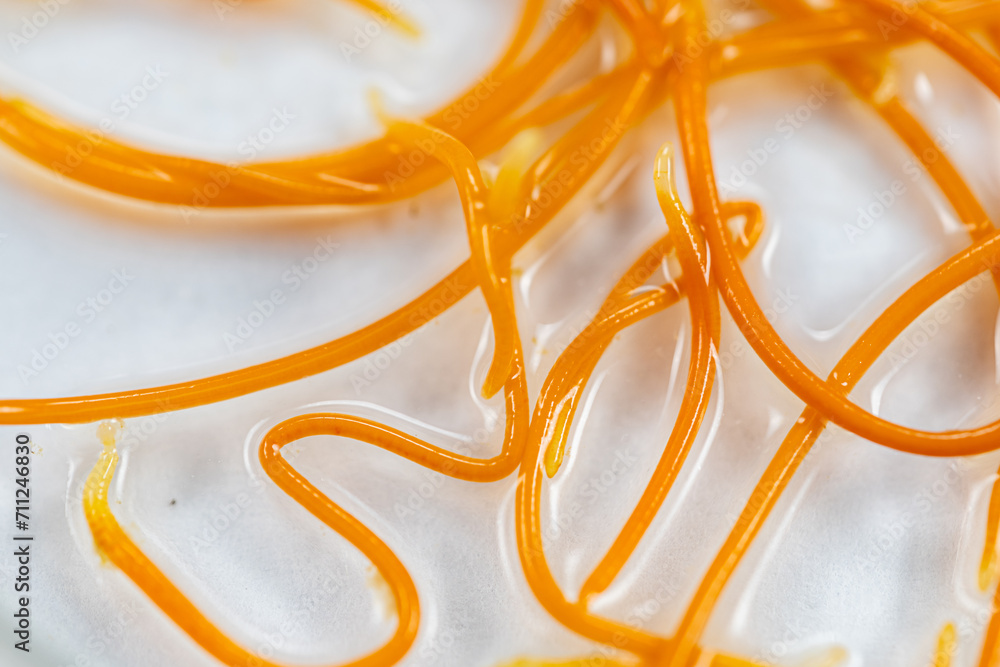 Study of Parasitic helminths (Trematodes) and Ascaris of fishes under a ...