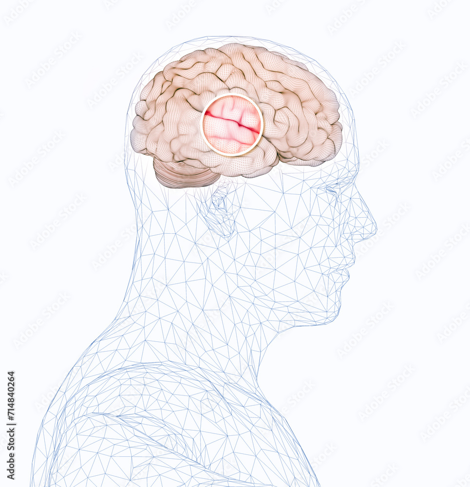 Memory lapses, forgetting things, degenerative disease. Brain problems ...