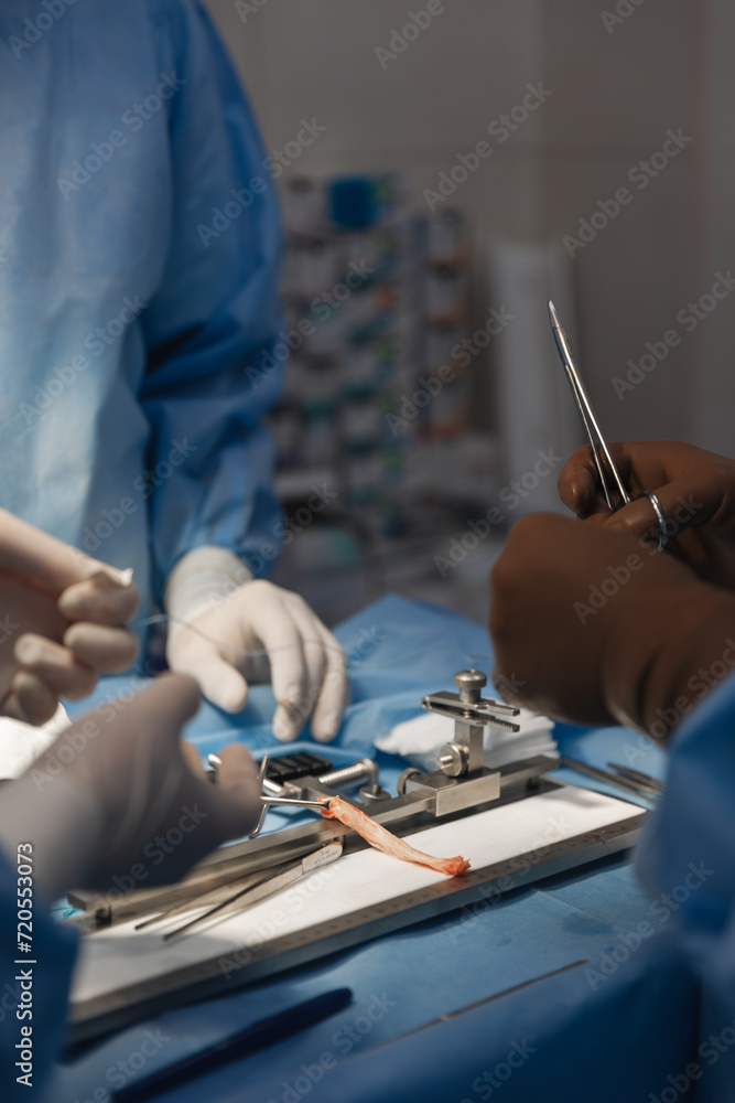 surgeons work on the cut part of the knee joint (muscular ligament ...
